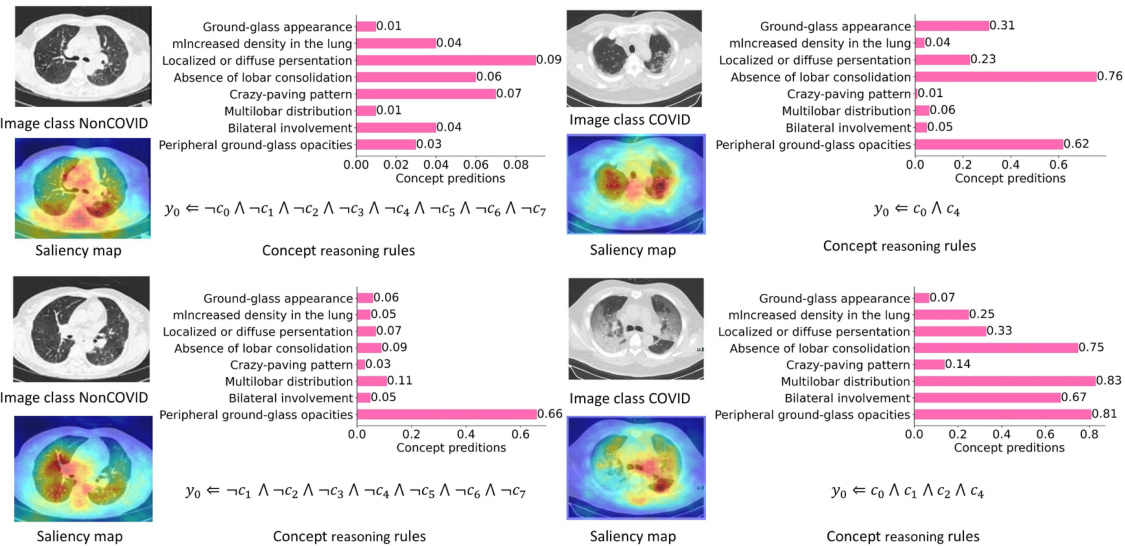 Towards Multi-dimensional Explanation Alignment for Medical Classification · NeurIPS 2024