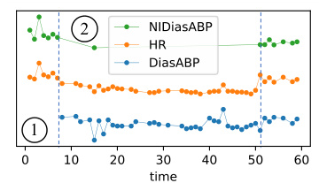 Knowledge-Empowered Dynamic Graph Network for Irregularly Sampled Medical Time Series · NeurIPS 2024