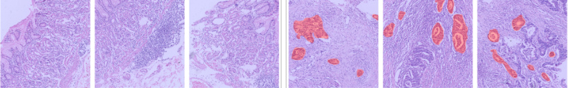 Are Multiple Instance Learning Algorithms Learnable for Instances ...