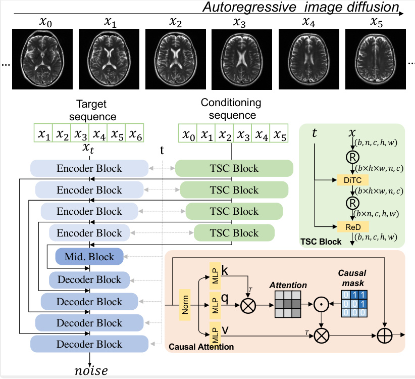Autoregressive Image Diffusion: Generation of Image Sequence and Application in MRI · NeurIPS 2024
