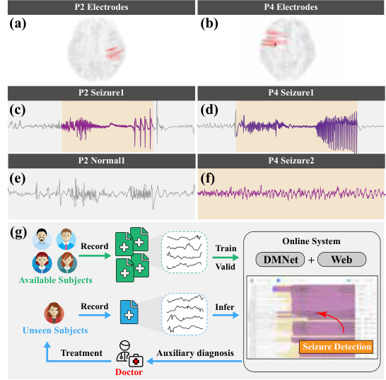 DMNet: Self-comparison Driven Model for Subject-independent Seizure Detection · NeurIPS 2024
