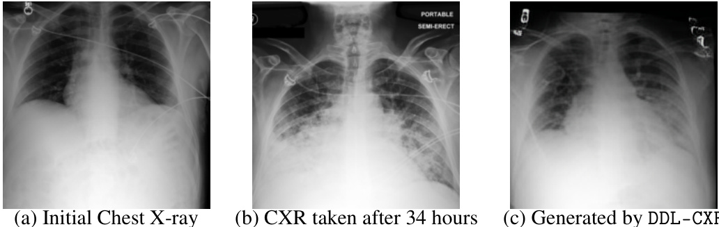 Addressing Asynchronicity in Clinical Multimodal Fusion via ...